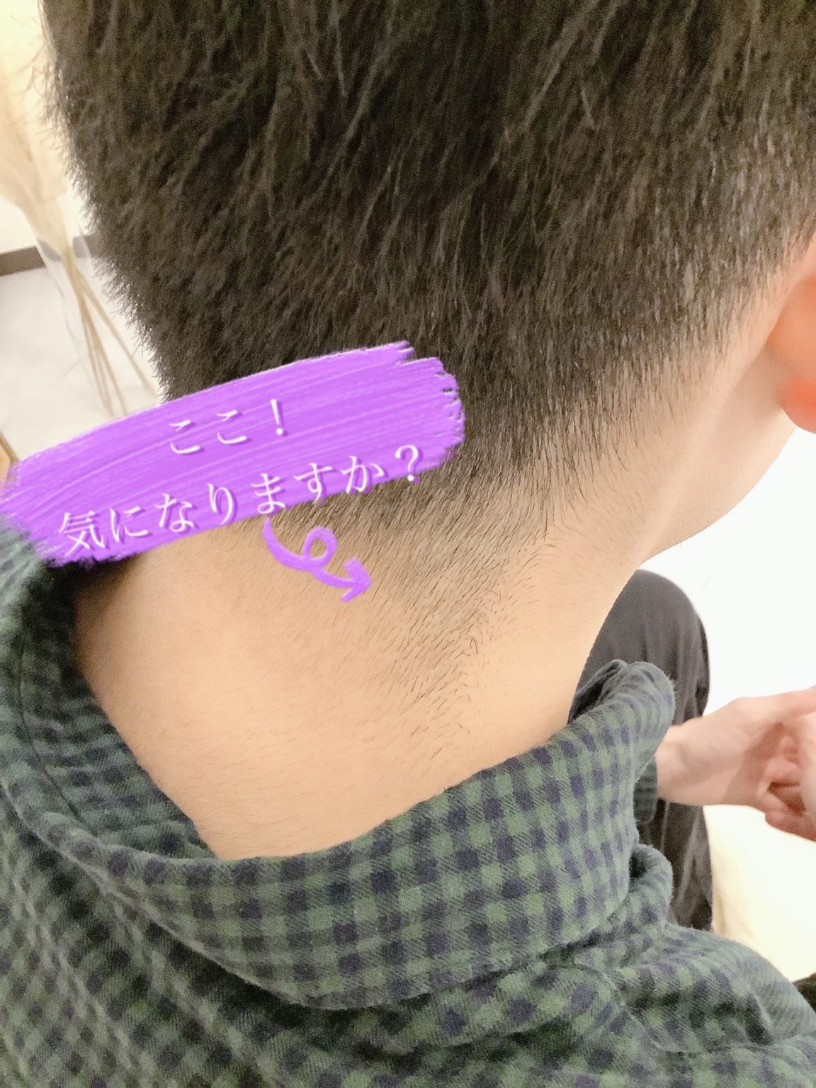 【メンズ脱毛】男性のうなじをキレイに見せるには